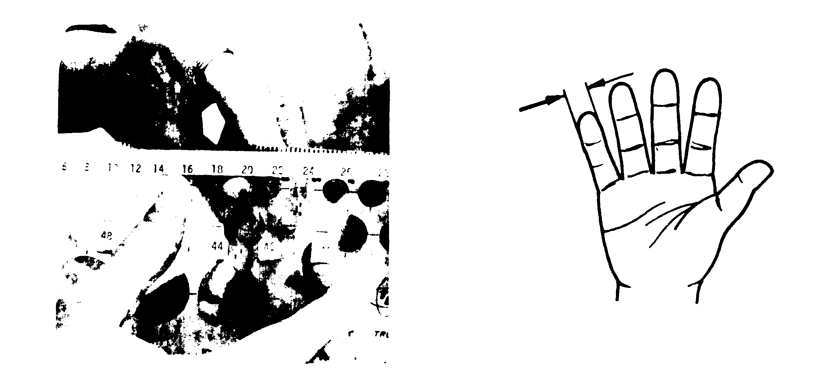 Physical Characteristics of Children